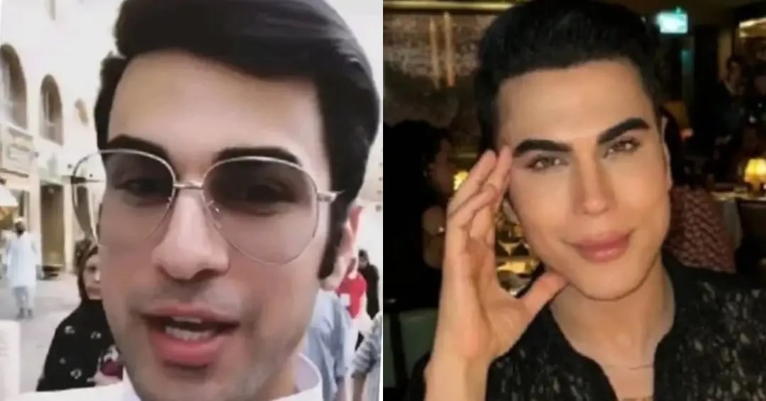 Latest Cosmetic Procedures of Pakistani Celebrities | Reviewit.pk